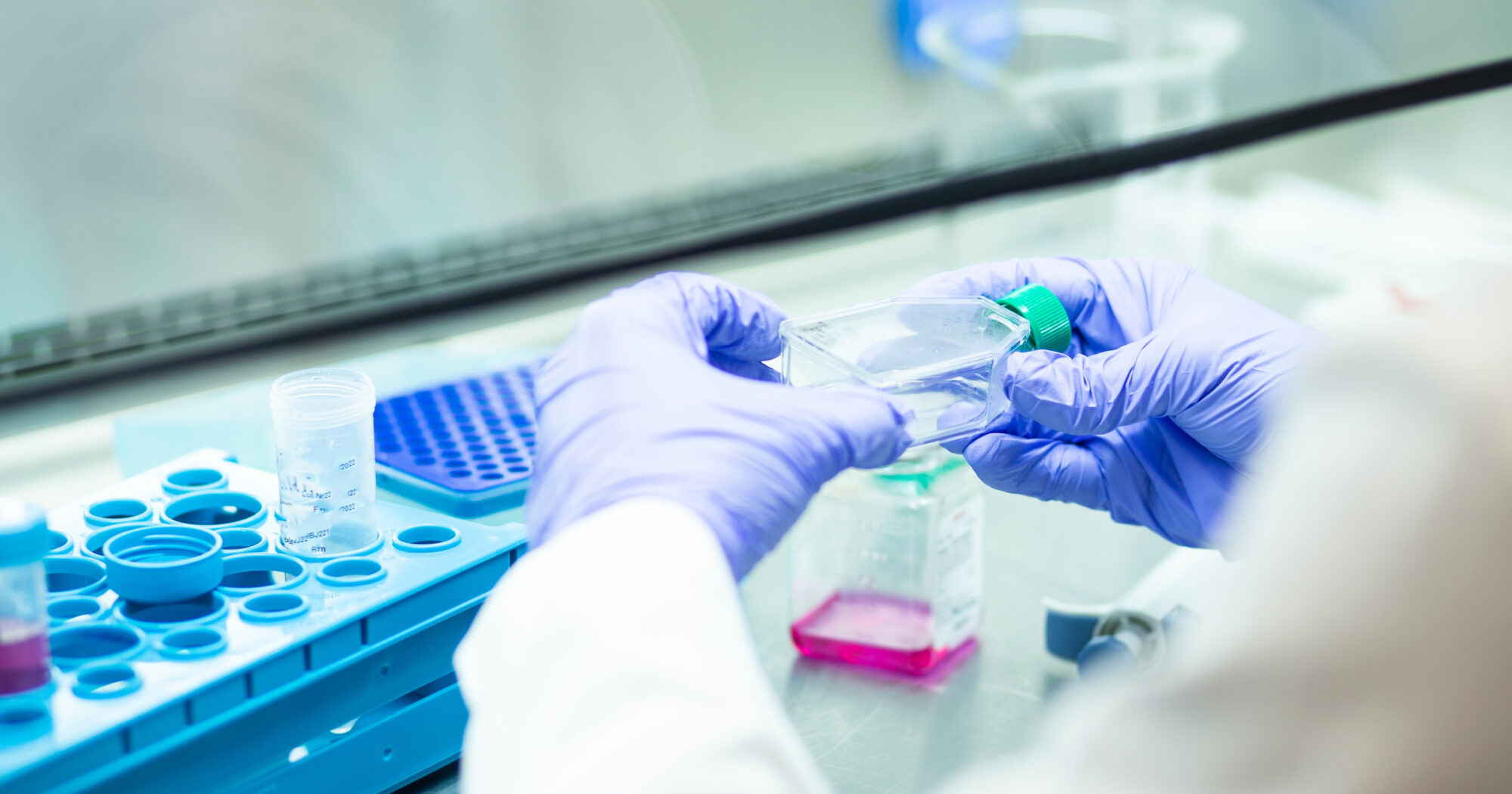 Microfluidic Cell Sorters for Gentle Sorting | NanoCellect